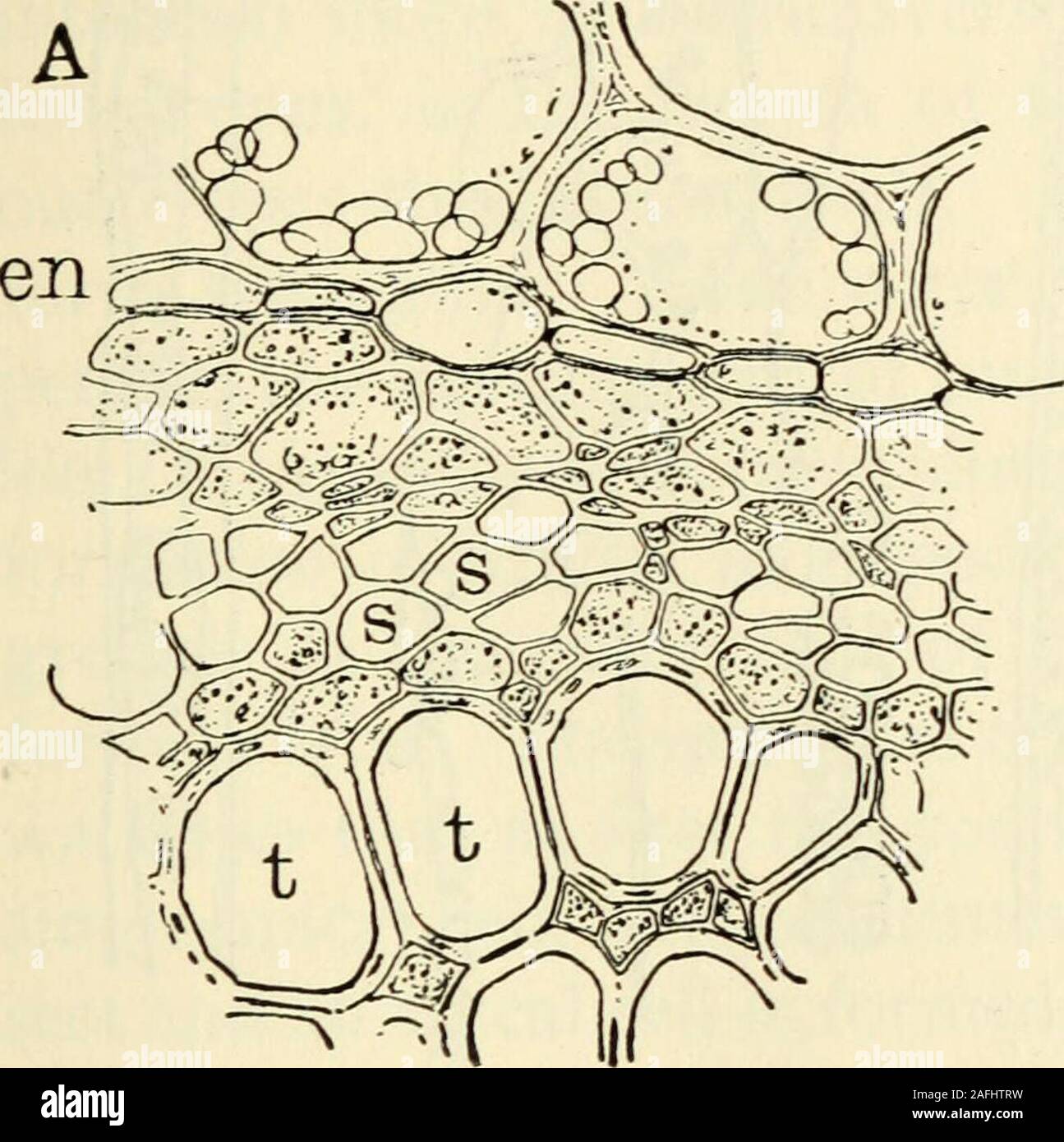 Tracheids Cross Section