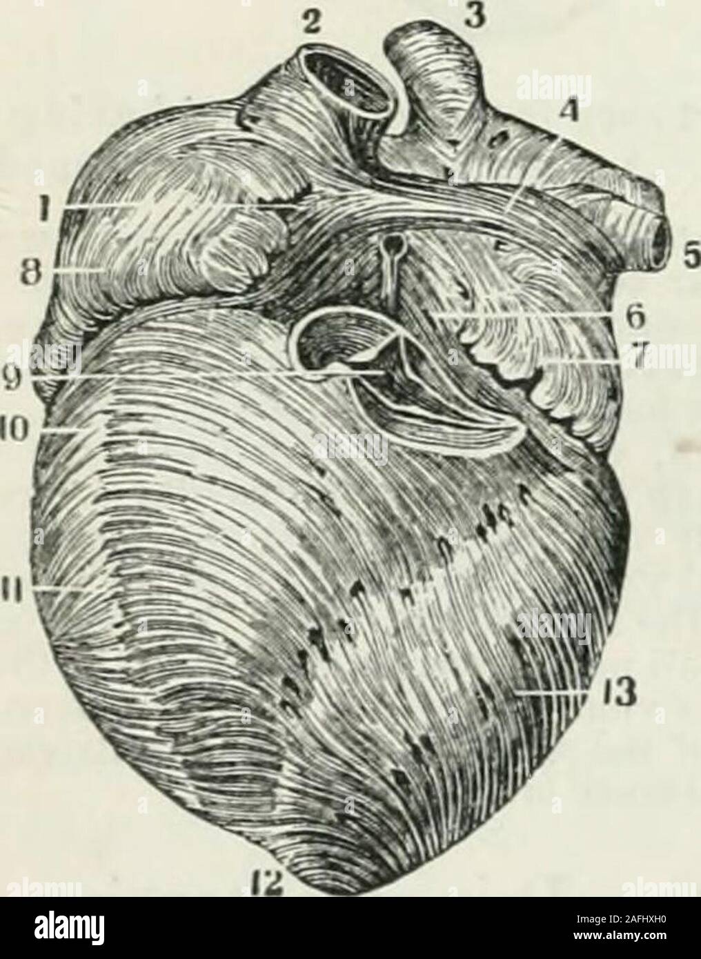Elastic tissue aorta hi-res stock photography and images - Alamy