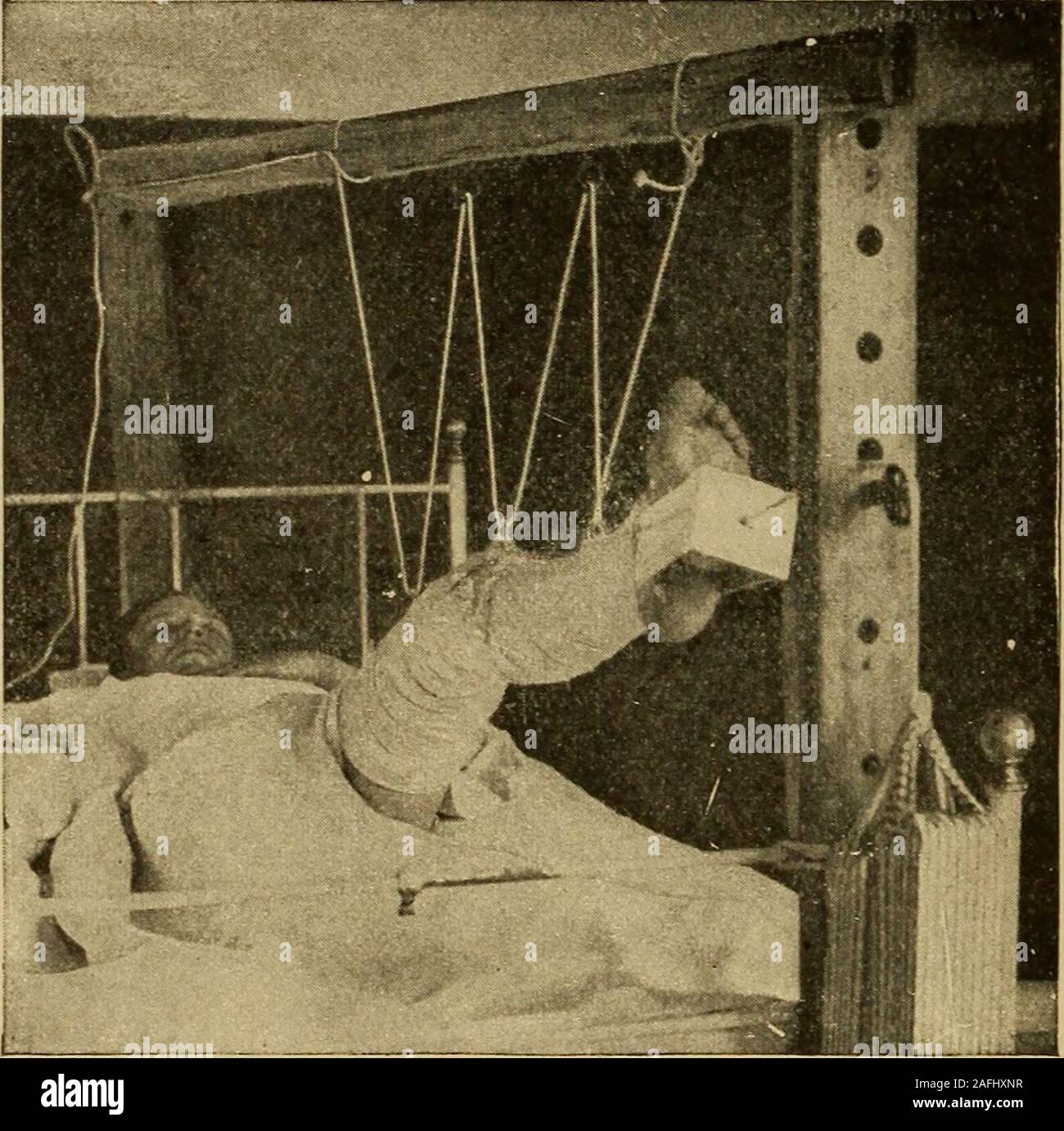 Retention sutures hi-res stock photography and images - Alamy