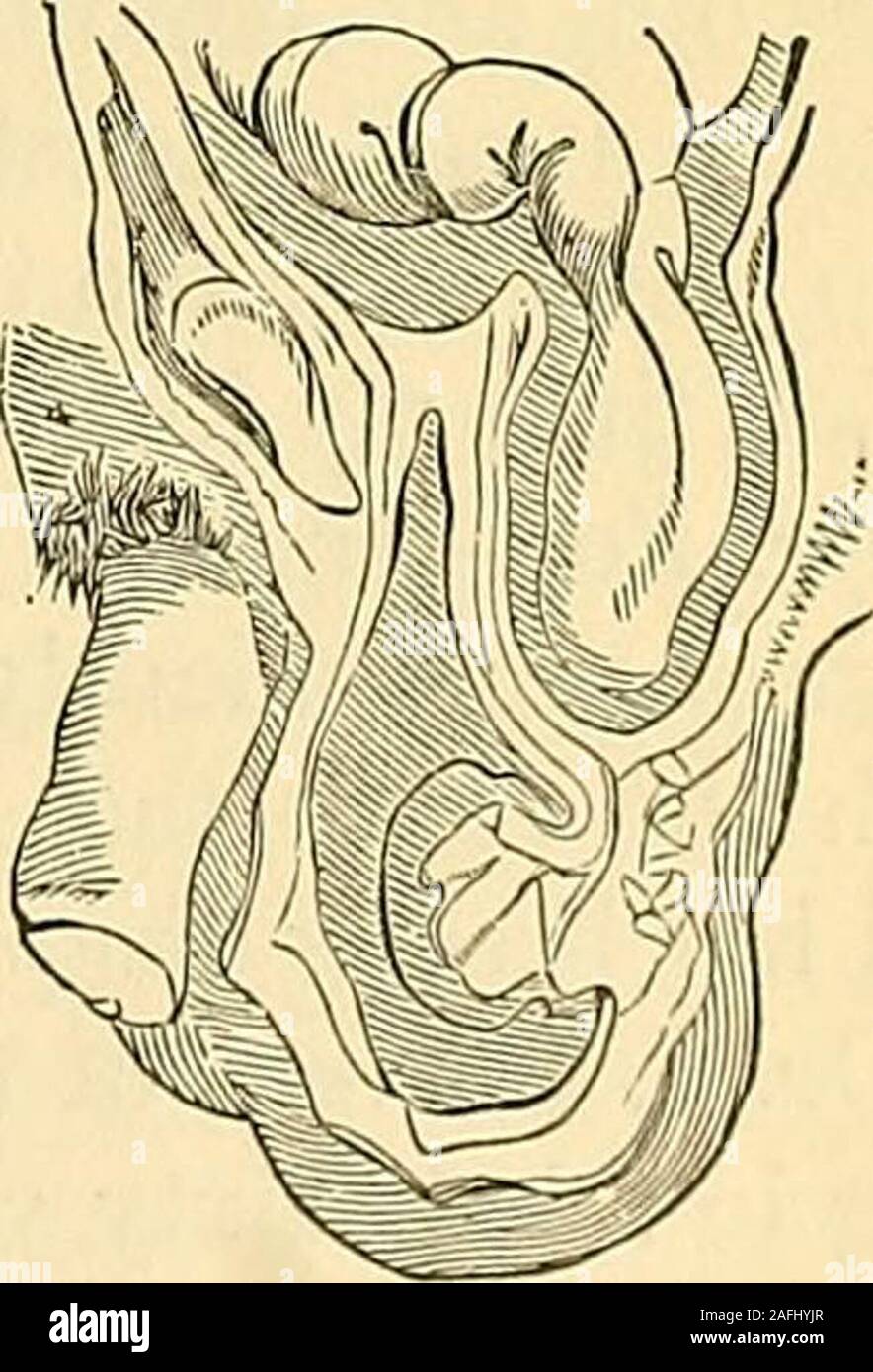 Tendinous ring hi-res stock photography and images - Alamy