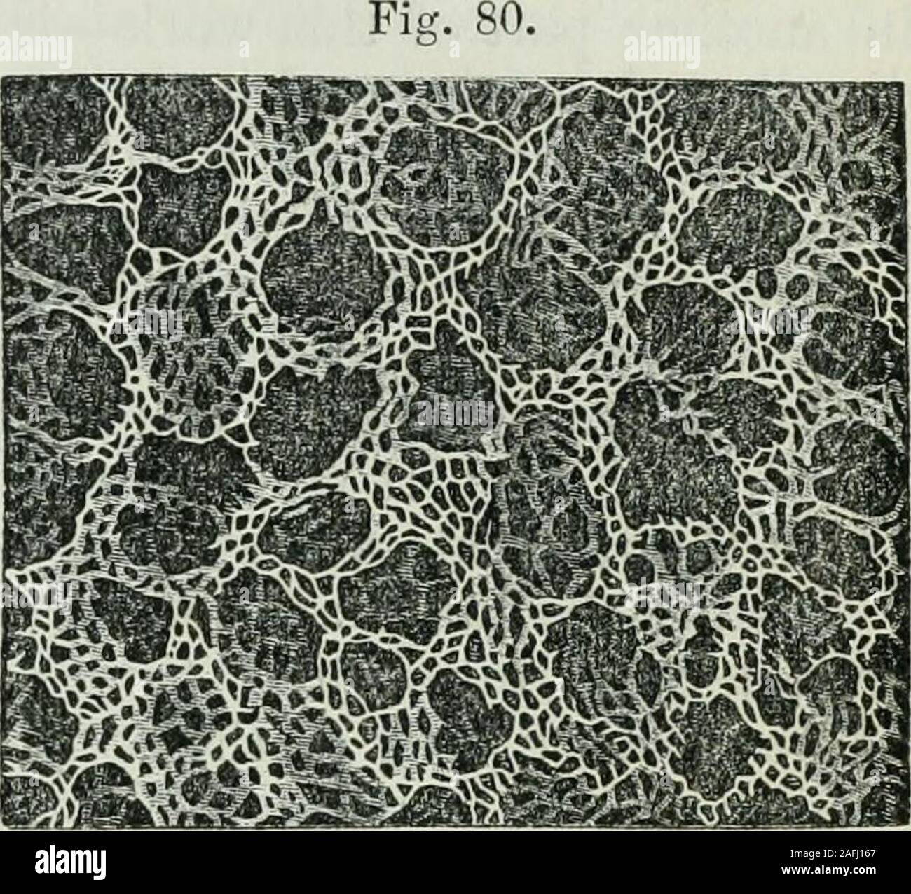 Human heart removed hi-res stock photography and images - Alamy