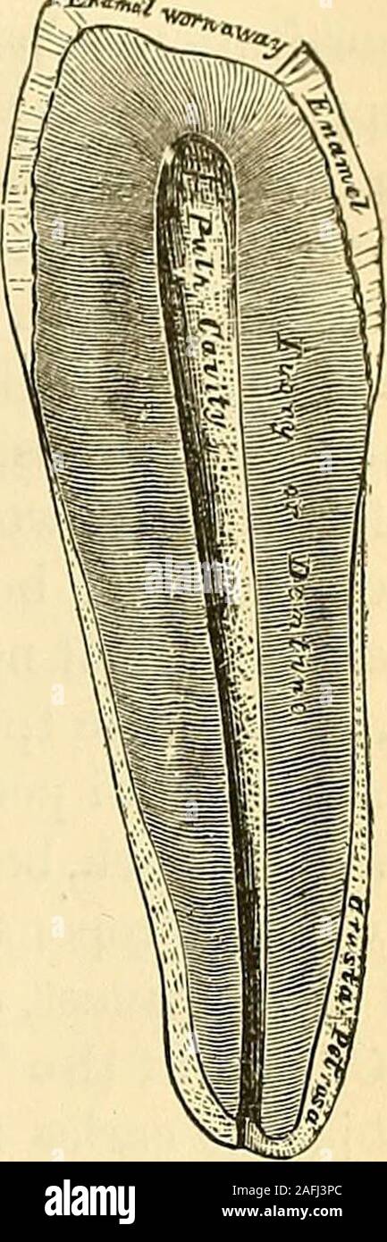 Surgery Blood Pulp High Resolution Stock Photography and Images - Alamy