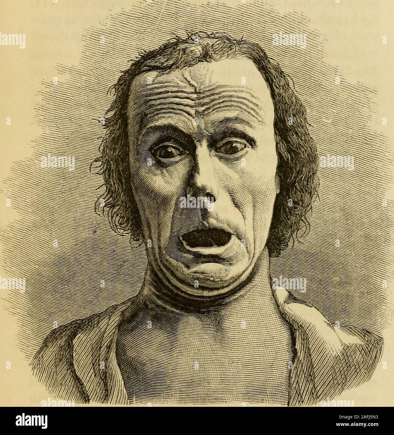 Transverse wrinkles hi-res stock photography and images - Alamy