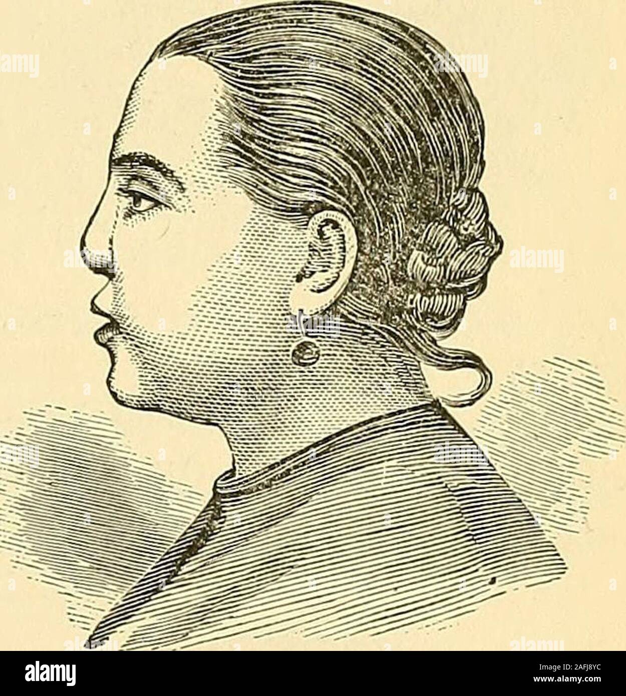 Cicatrization hi-res stock photography and images - Alamy