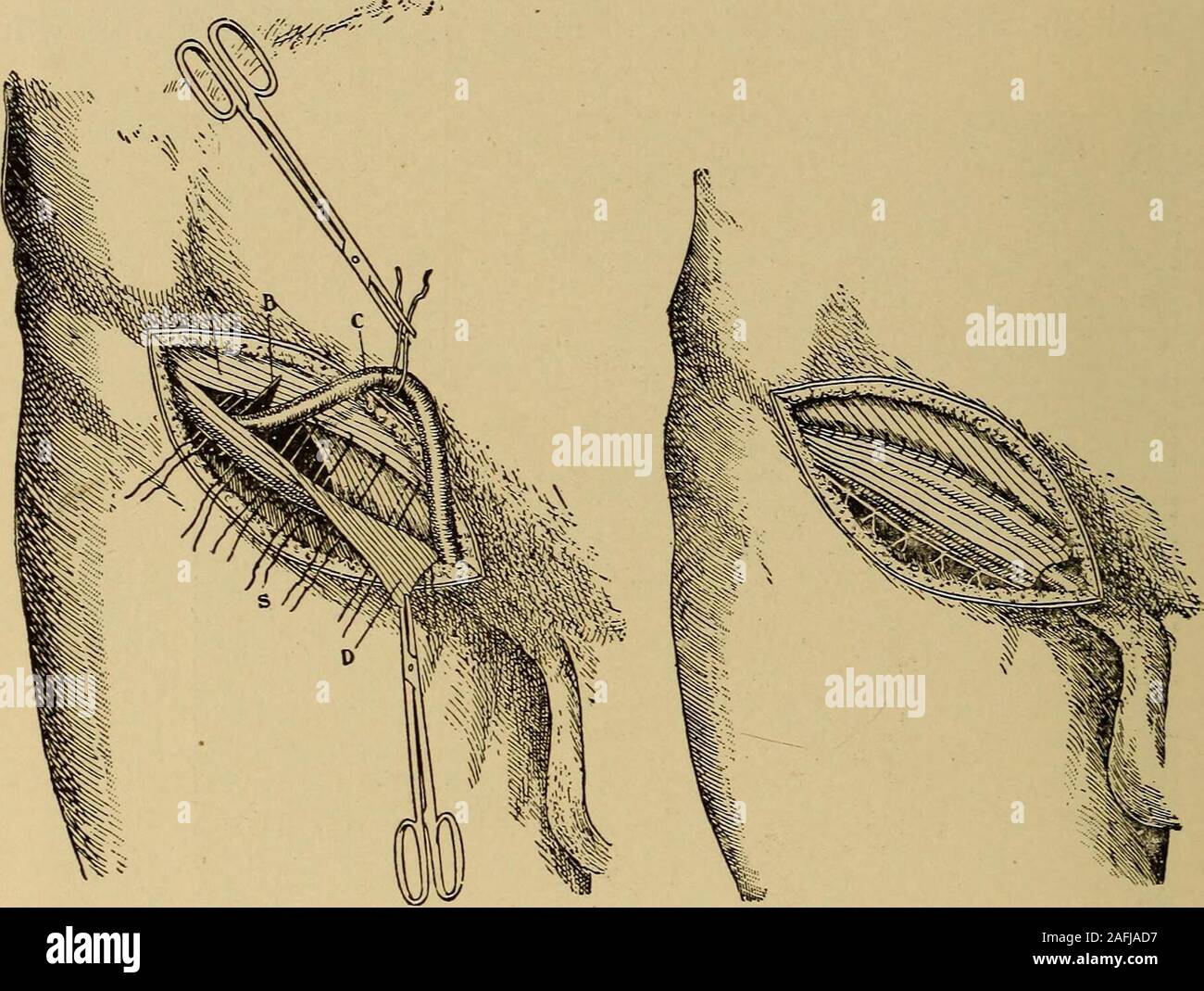 Wyllys andrews hi-res stock photography and images - Alamy
