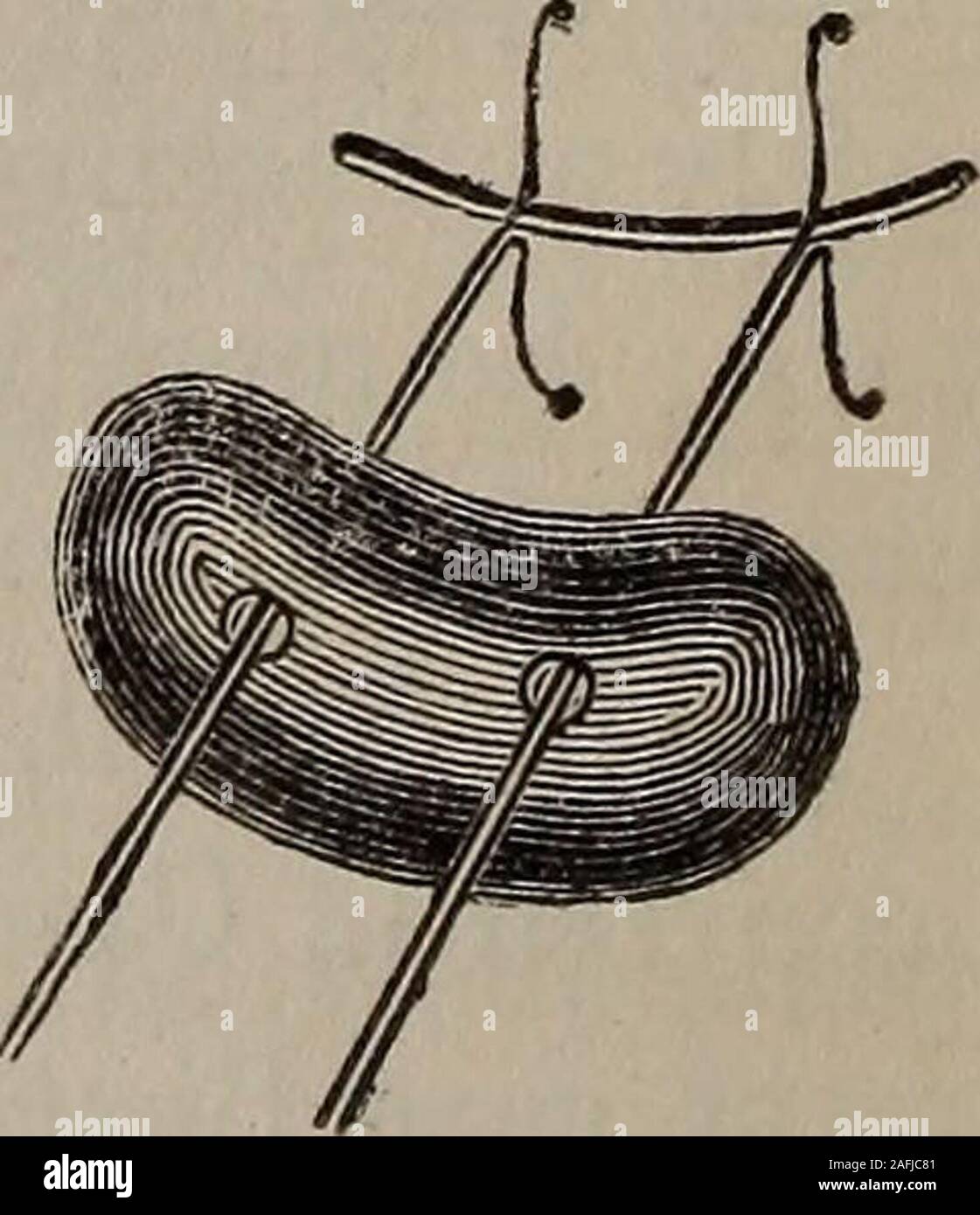 C fistule hi-res stock photography and images - Alamy