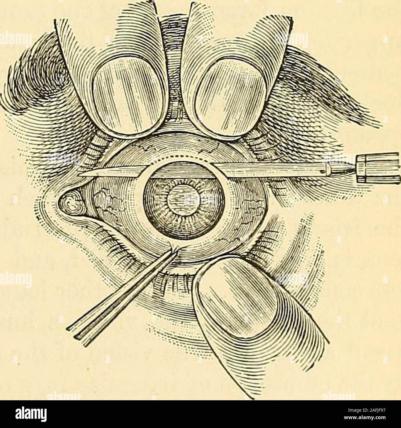 . The principles and practice of surgery. re skill and adroitness. This ...