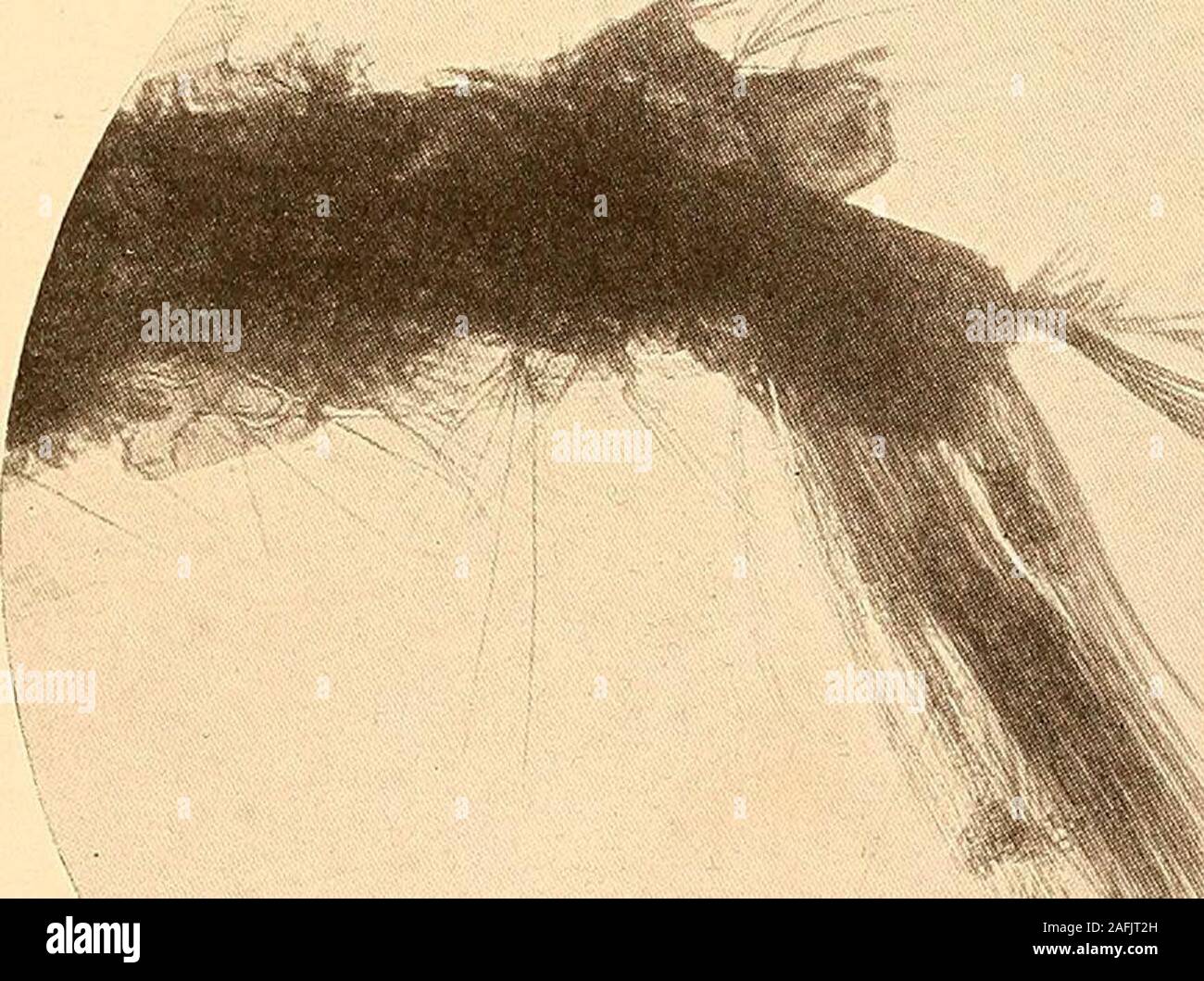 . A practical study of malaria. Fig. 15.—Head of anopheles. Magnified ...