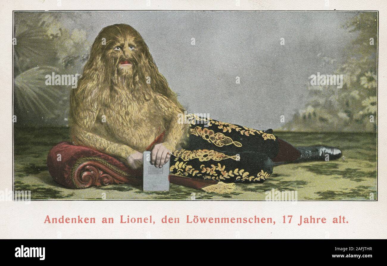 Lionel The Lion Faced Man