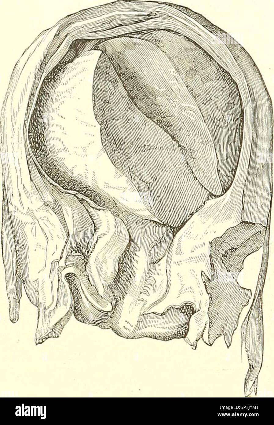Uterus lateral view hi-res stock photography and images - Alamy