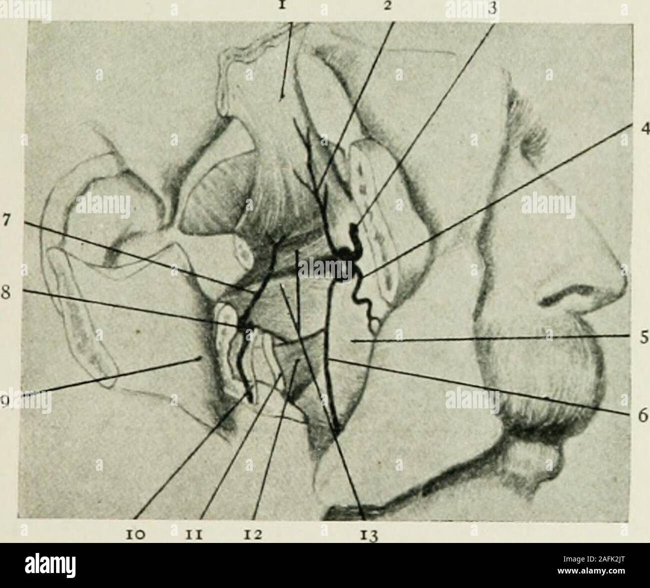 . Local and regional anesthesia : with chapters on spinal, epidural ...