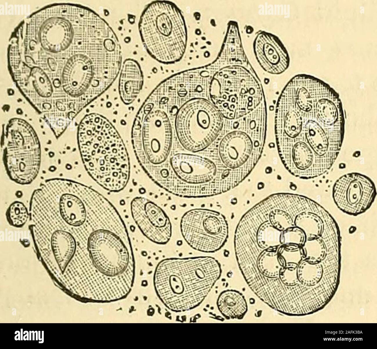 Termination type hi-res stock photography and images - Alamy