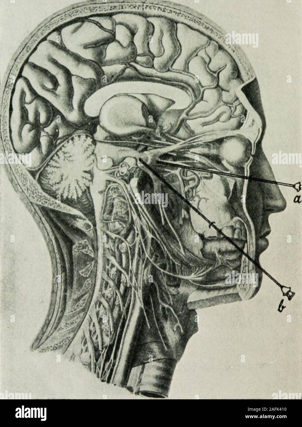 . Local and regional anesthesia : with chapters on spinal, epidural ...