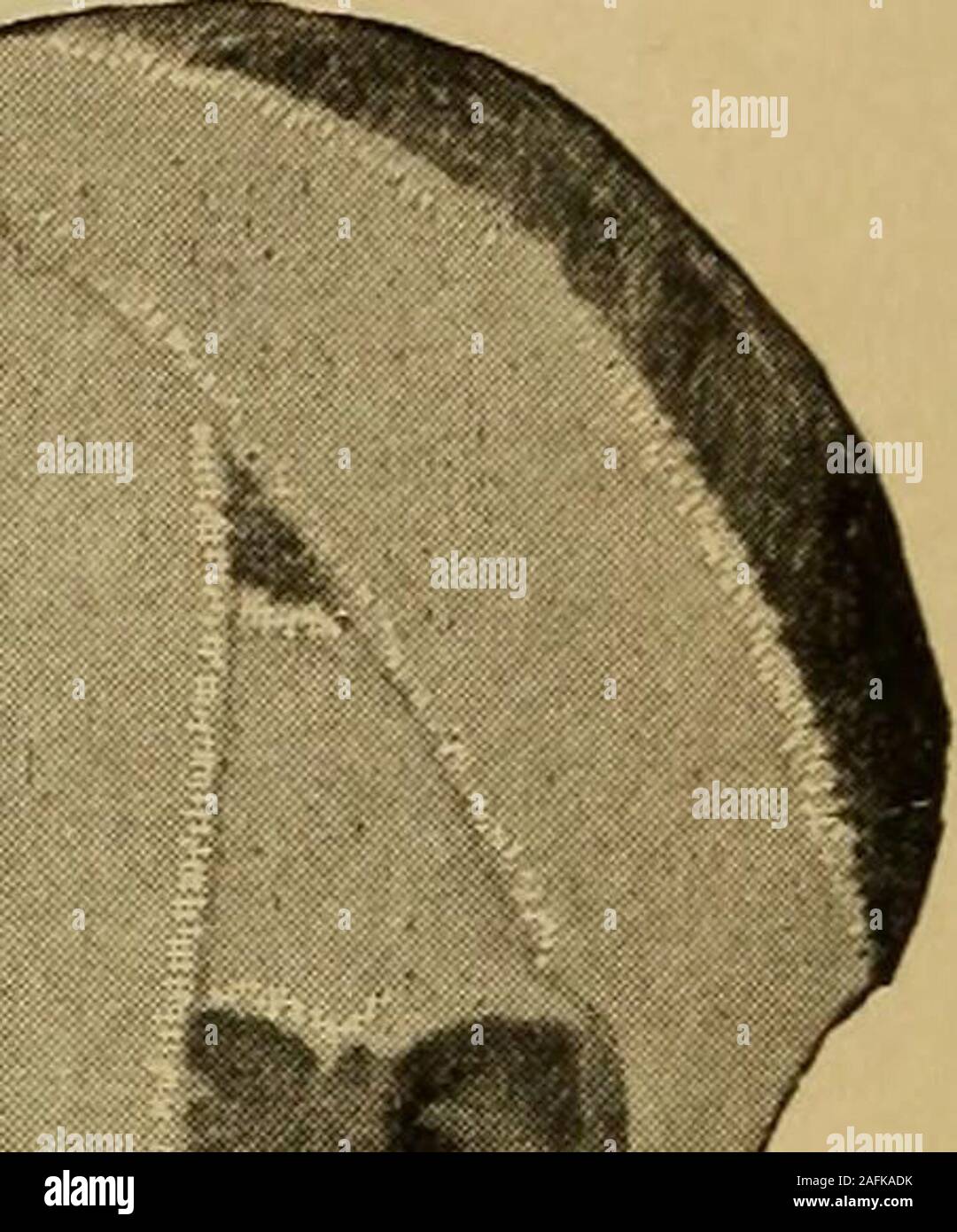 Modified thorax hi-res stock photography and images - Alamy