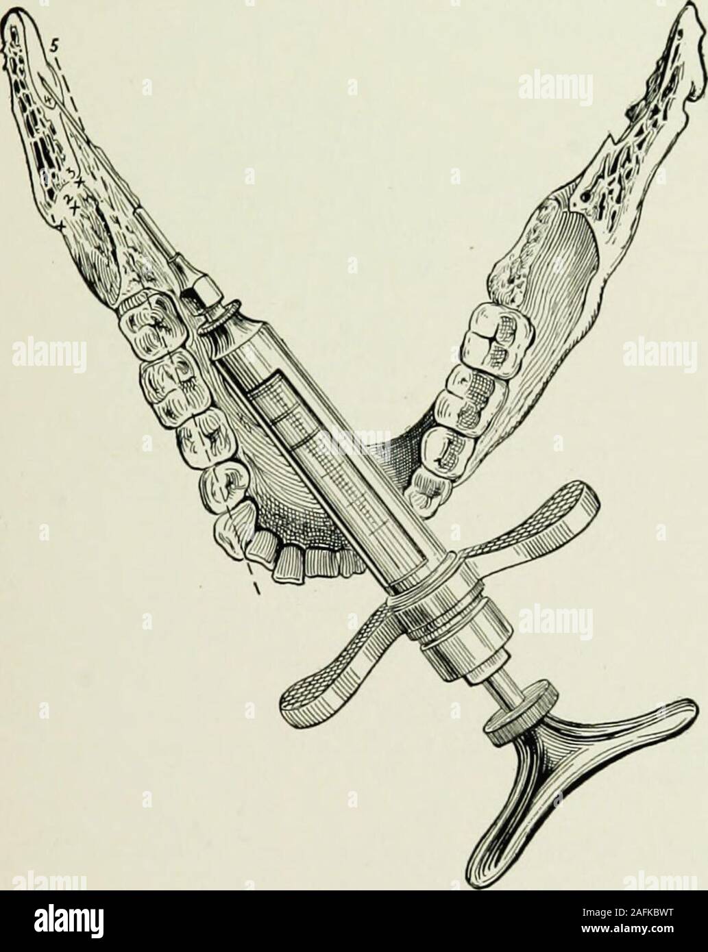 Bony ridges hi-res stock photography and images - Alamy