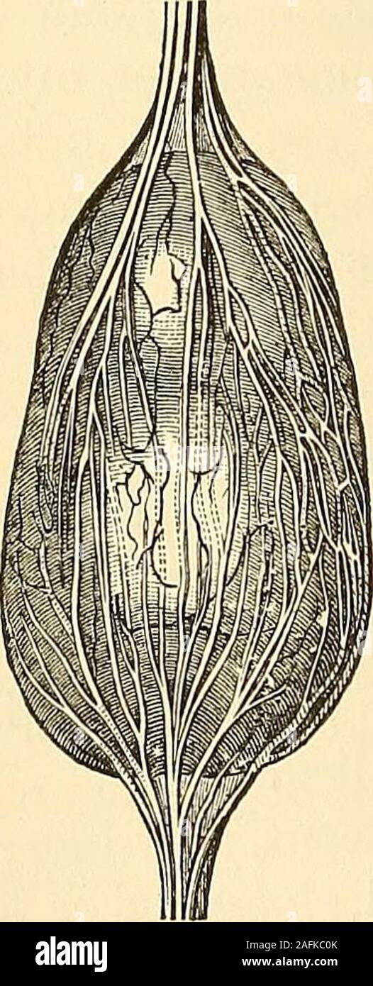 . The principles and practice of surgery. Fibroplastic Cells. Fig. 242 ...