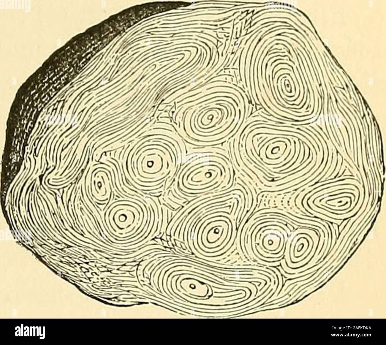 Subcutaneous areolar tissue hi-res stock photography and images - Alamy