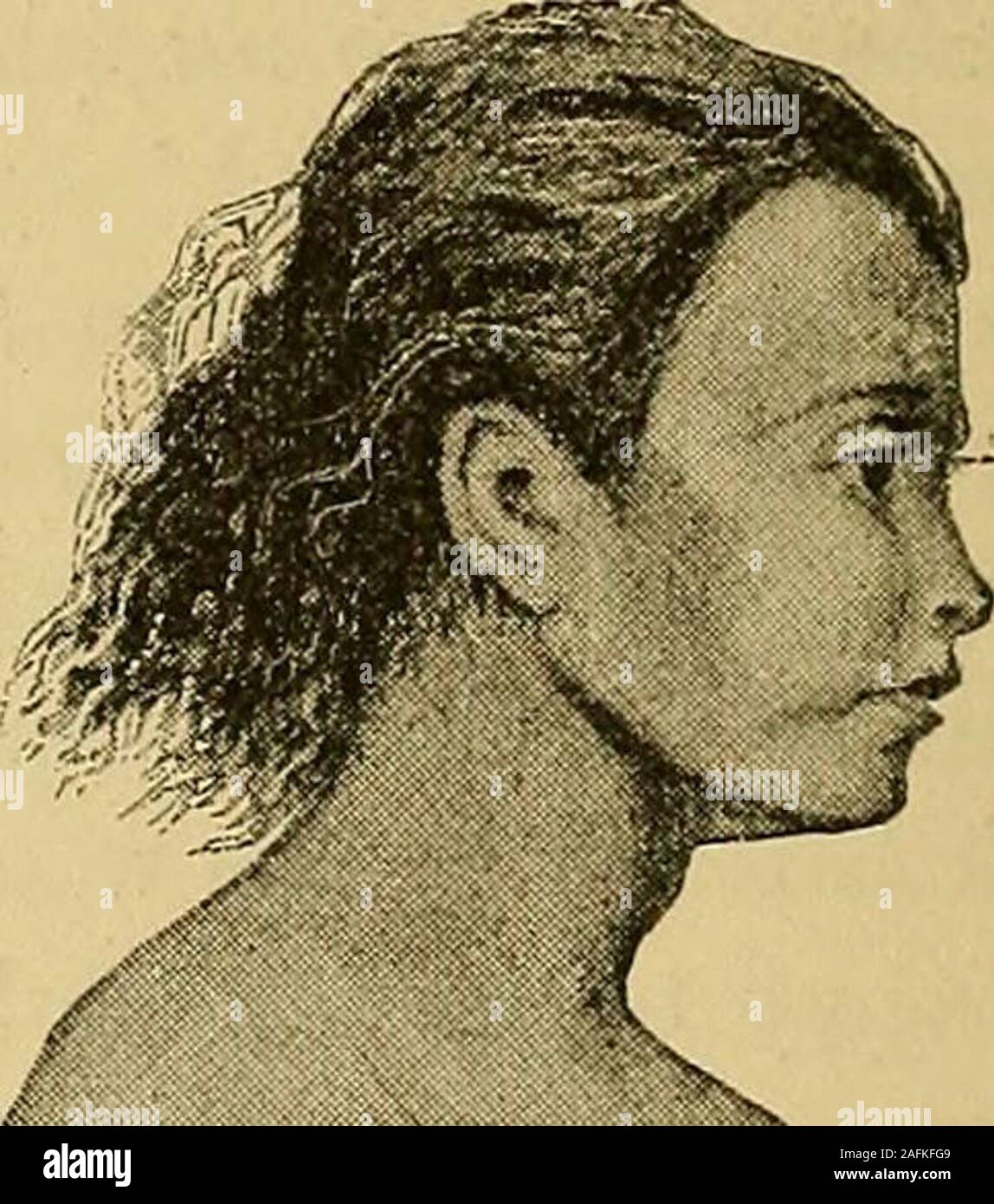 Negrito woman hi-res stock photography and images - Alamy