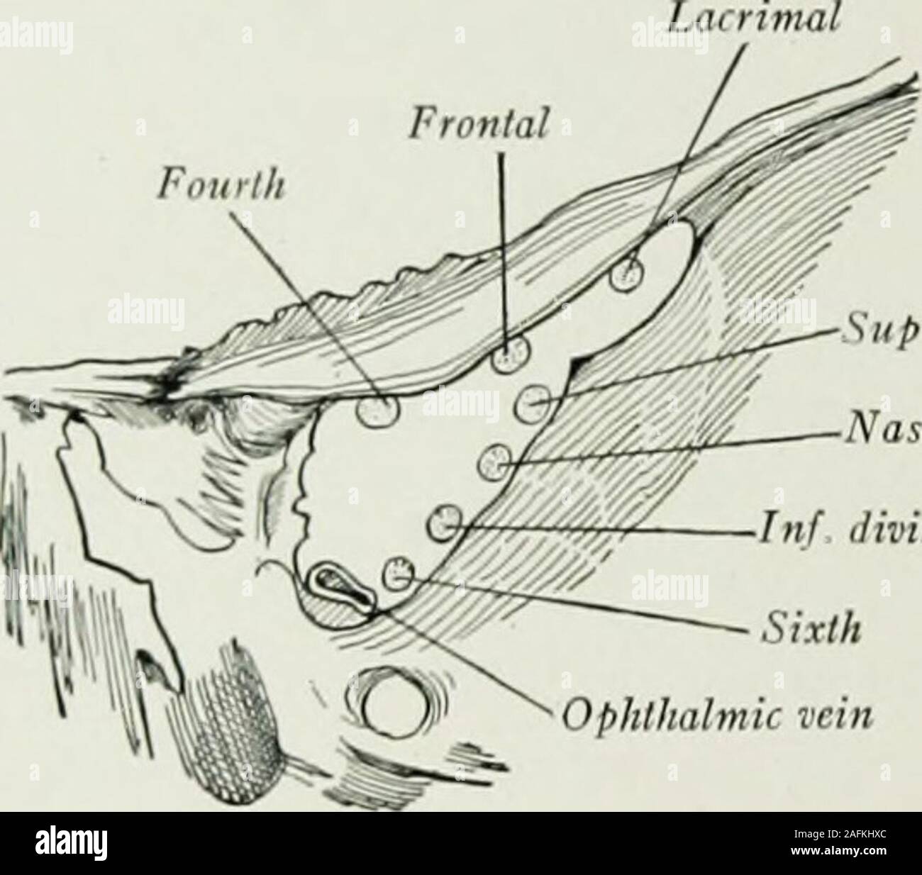 . Local and regional anesthesia : with chapters on spinal, epidural ...