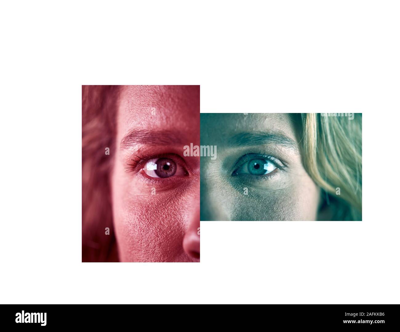 Composite Concept Image Showing Detail Of Face Of Young Woman Suffering ...