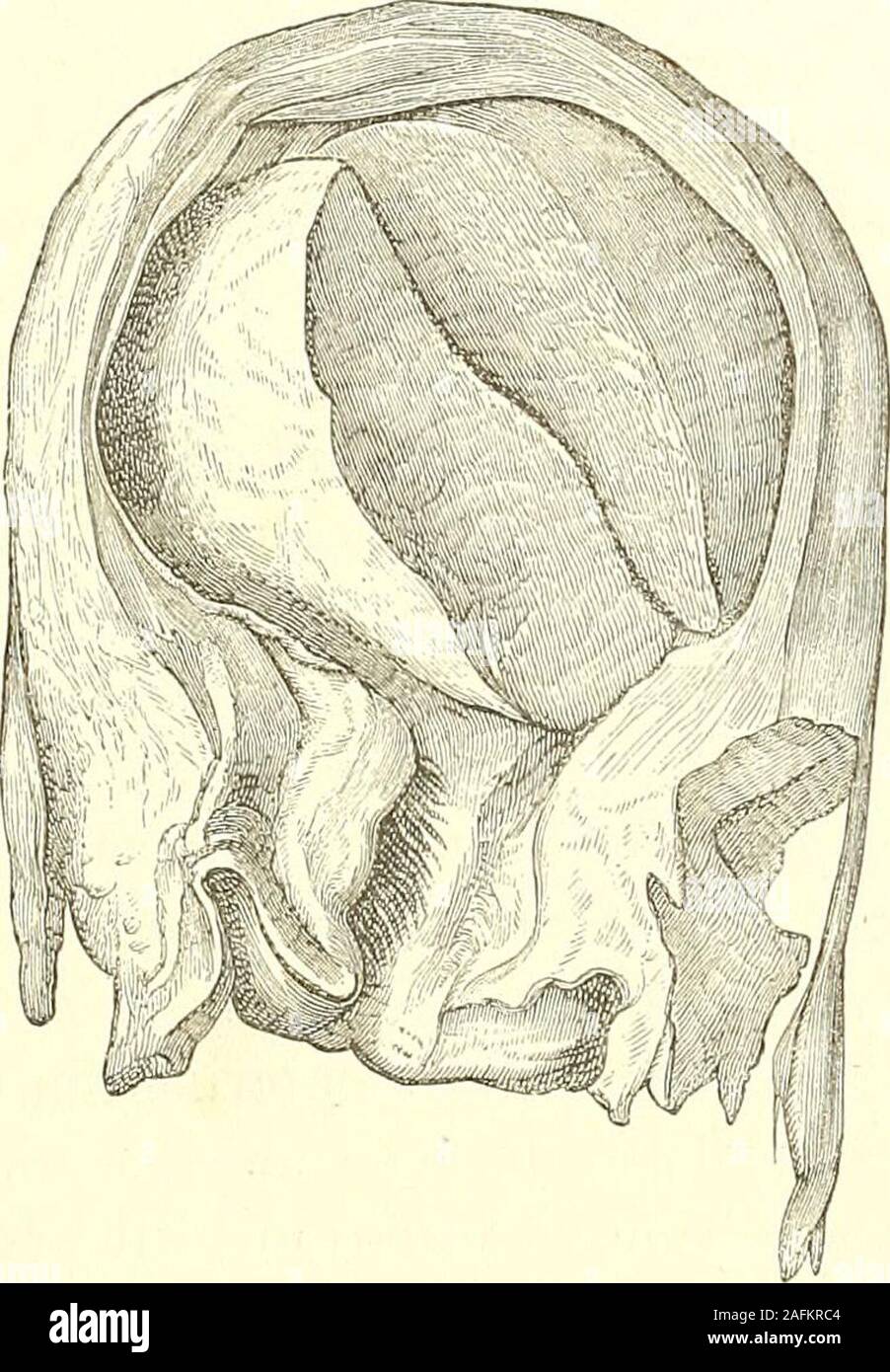 . The diagnosis, pathology and treatment of diseases of women including ...