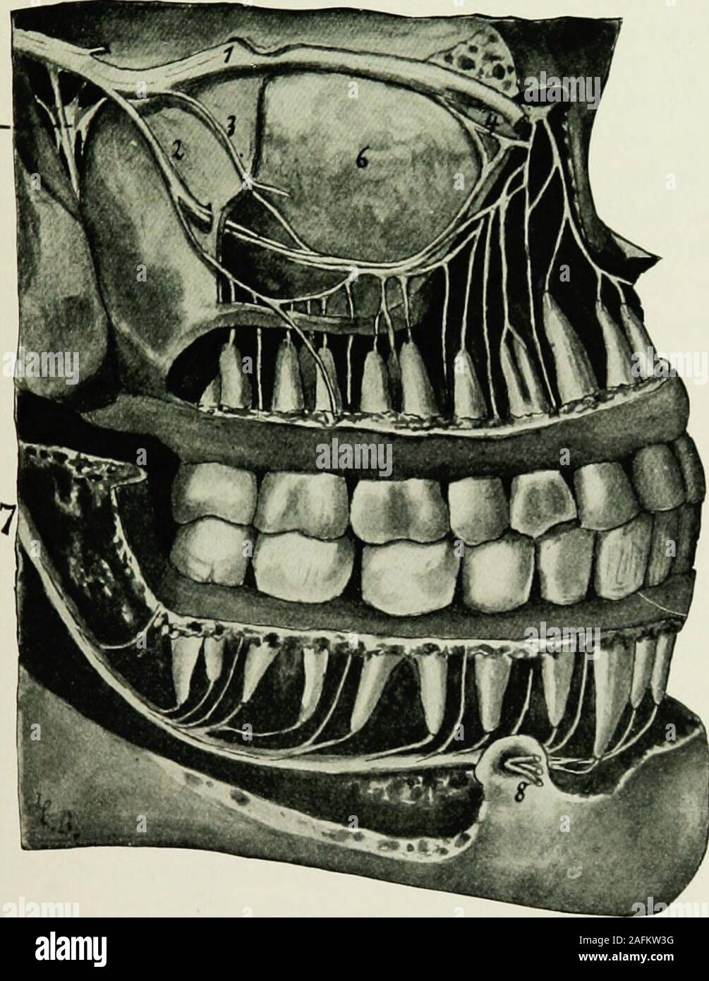Infratrochlear Nerve