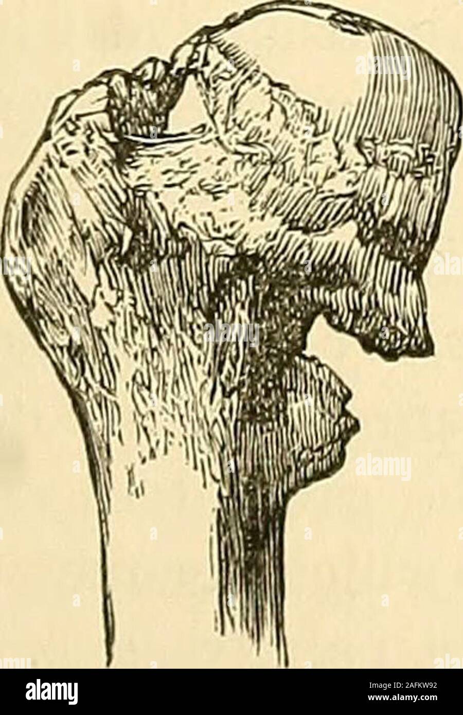 Flattened neck hi-res stock photography and images - Alamy