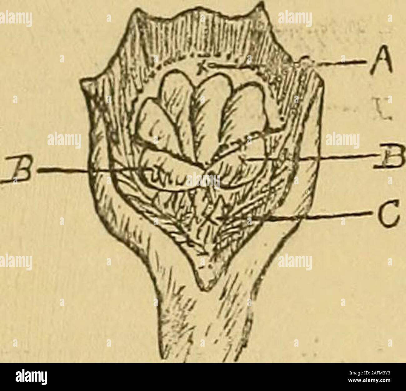 Stigmatic cavity hi-res stock photography and images - Alamy