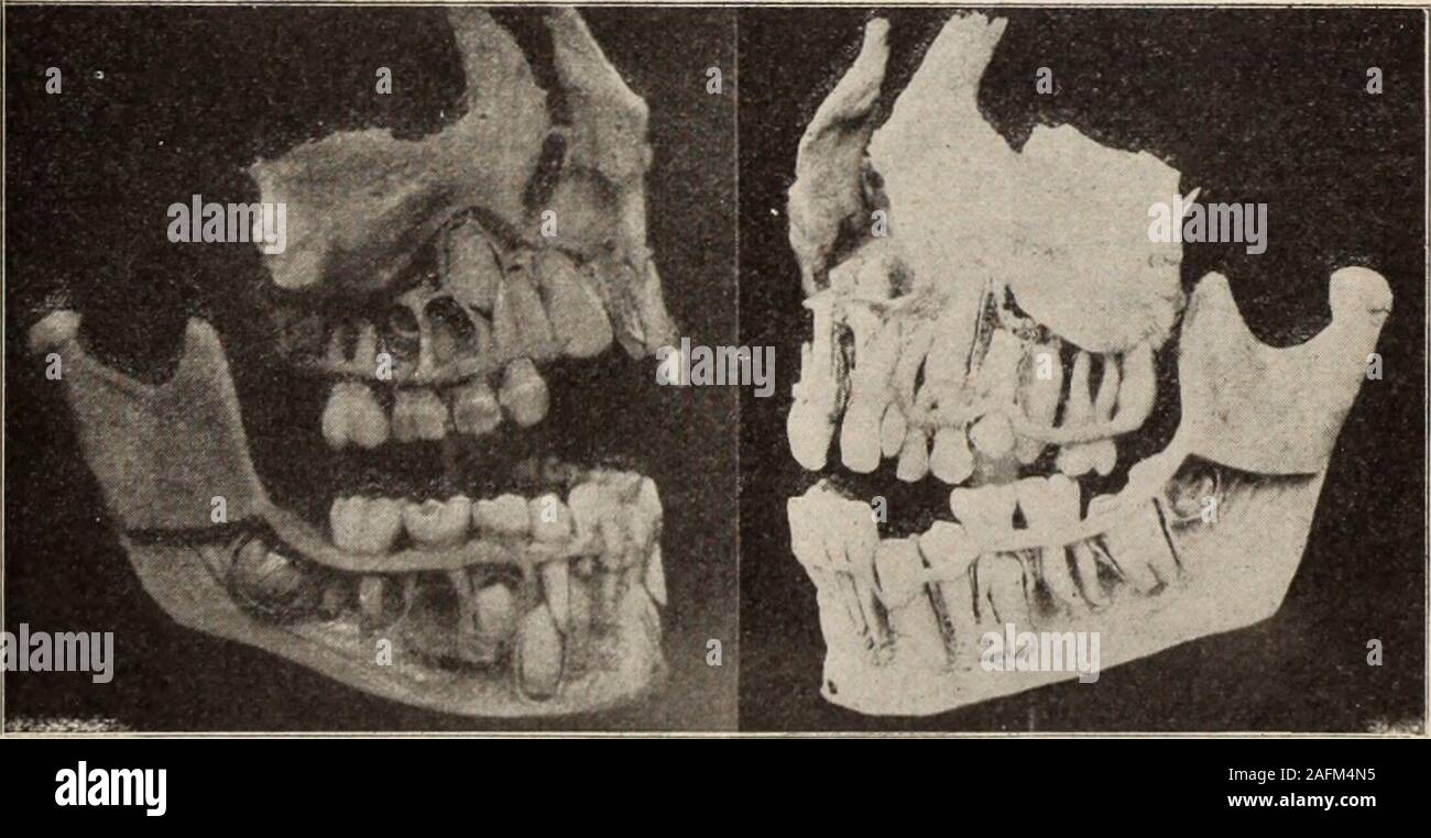 . Dental summary.. Y 795 Seventh Slide This is a side view at the same ...