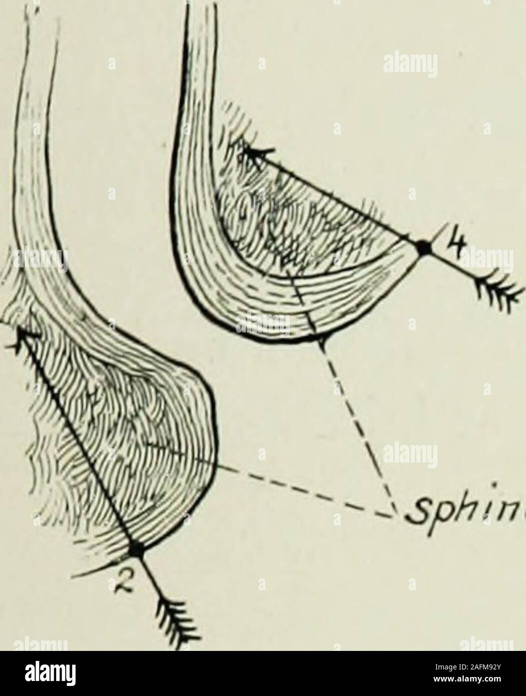Epidural injections hi-res stock photography and images - Alamy