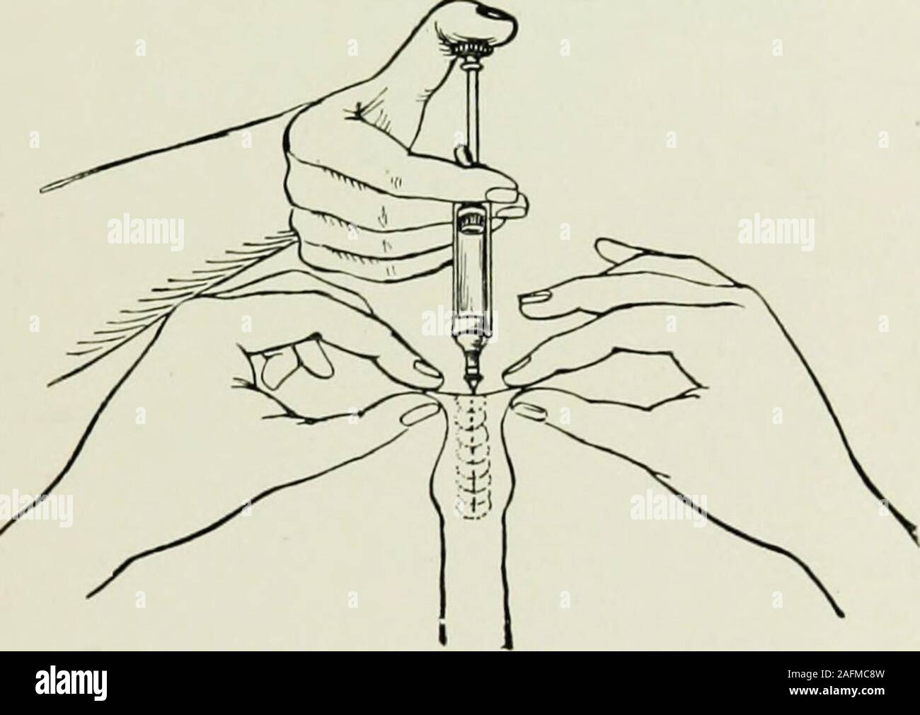 . Local and regional anesthesia : with chapters on spinal, epidural ...