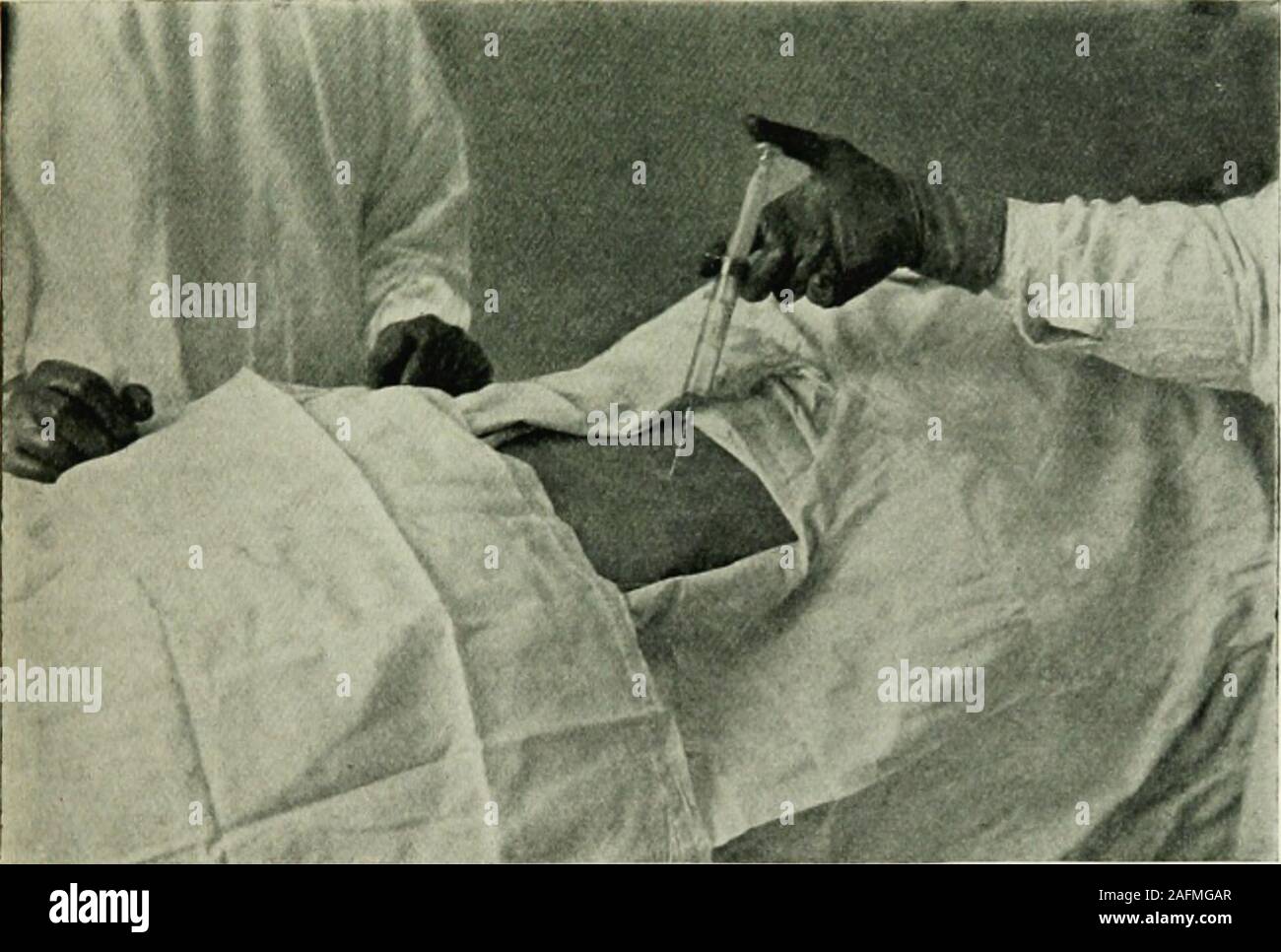 . Local and regional anesthesia : with chapters on spinal, epidural ...