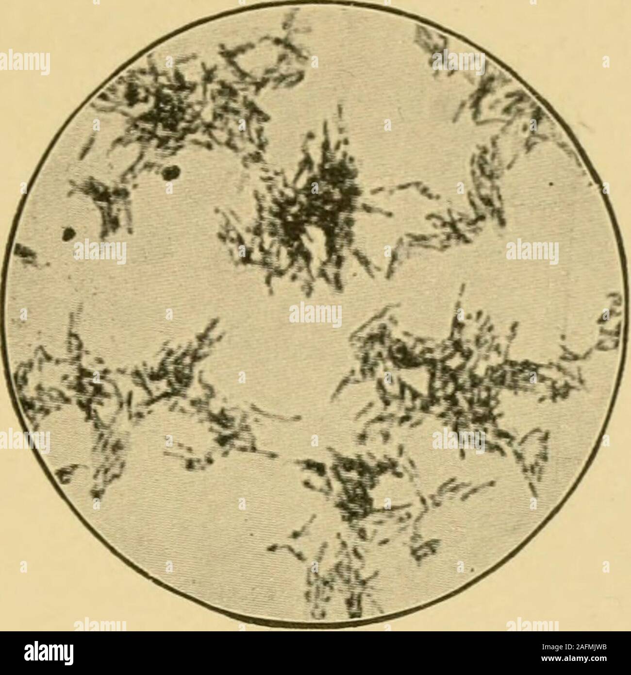 Bacilli gram hi-res stock photography and images - Alamy