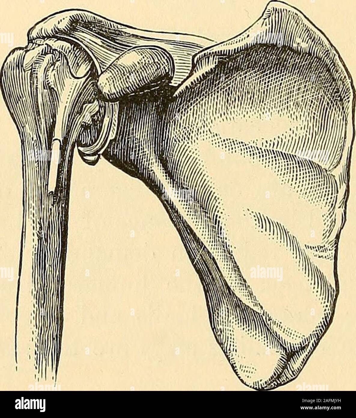 . The principles and practice of surgery. Subspinous Dislocation ...