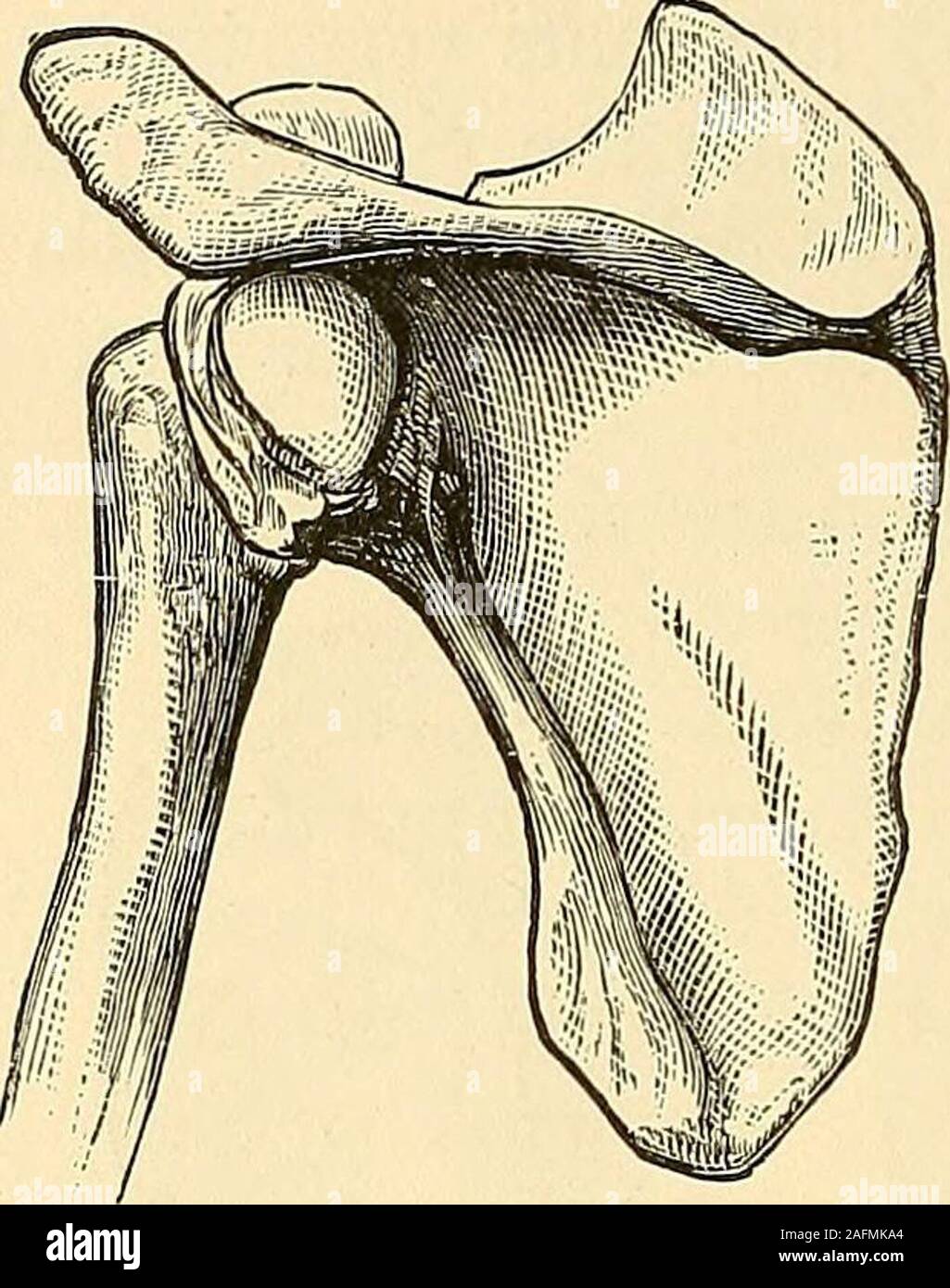 Subclavicular hi-res stock photography and images - Alamy