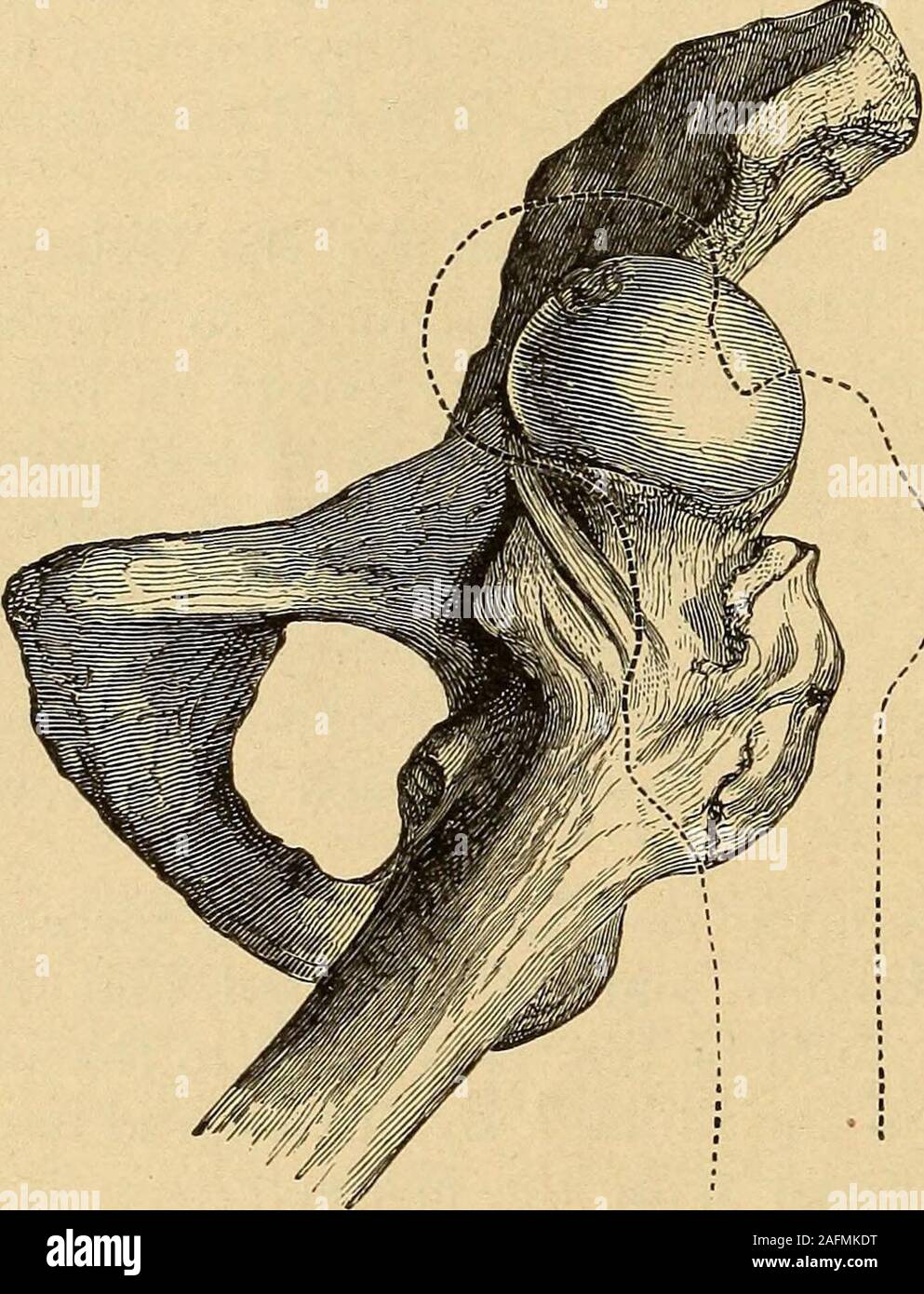 . A practical treatise on fractures and dislocations. Vortriitro. No. S ...