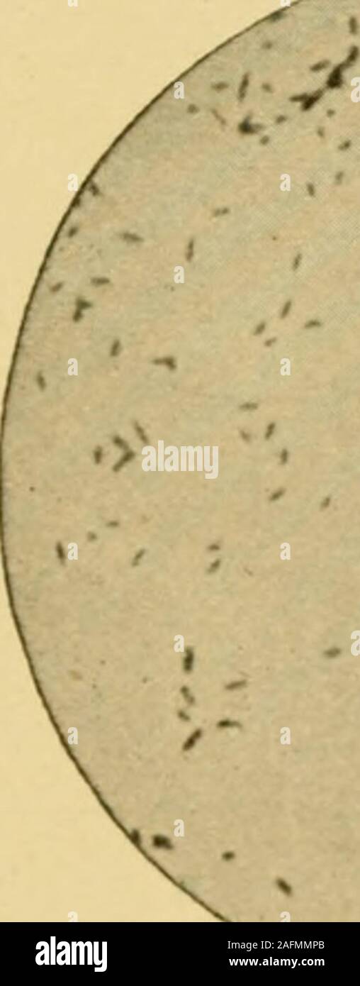 . Applied bacteriology for nurses. Fig. 57.—Micrococcus of Malta fever ...