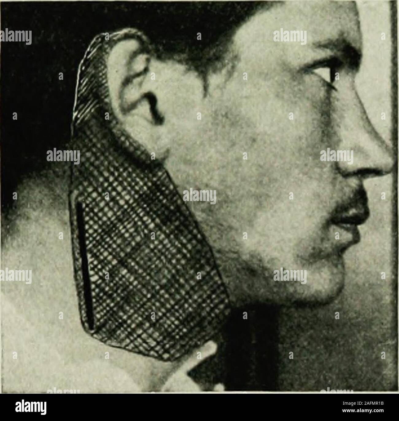 Epidural injections hi-res stock photography and images - Alamy