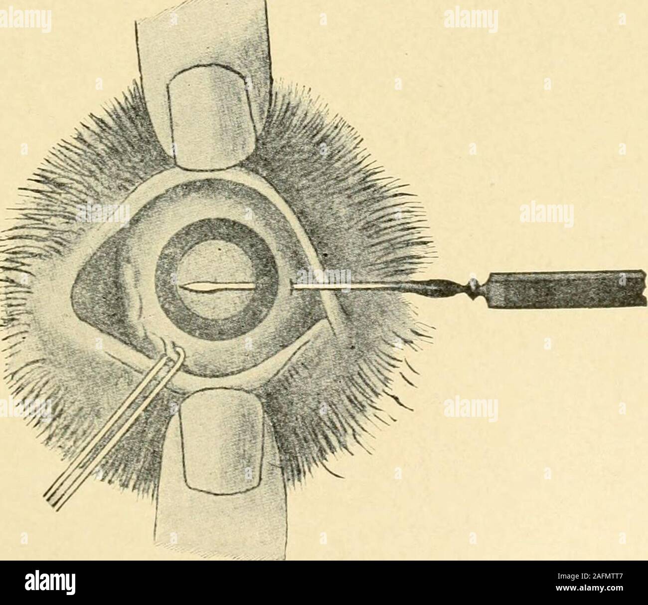 Dislocation lens hi-res stock photography and images - Alamy