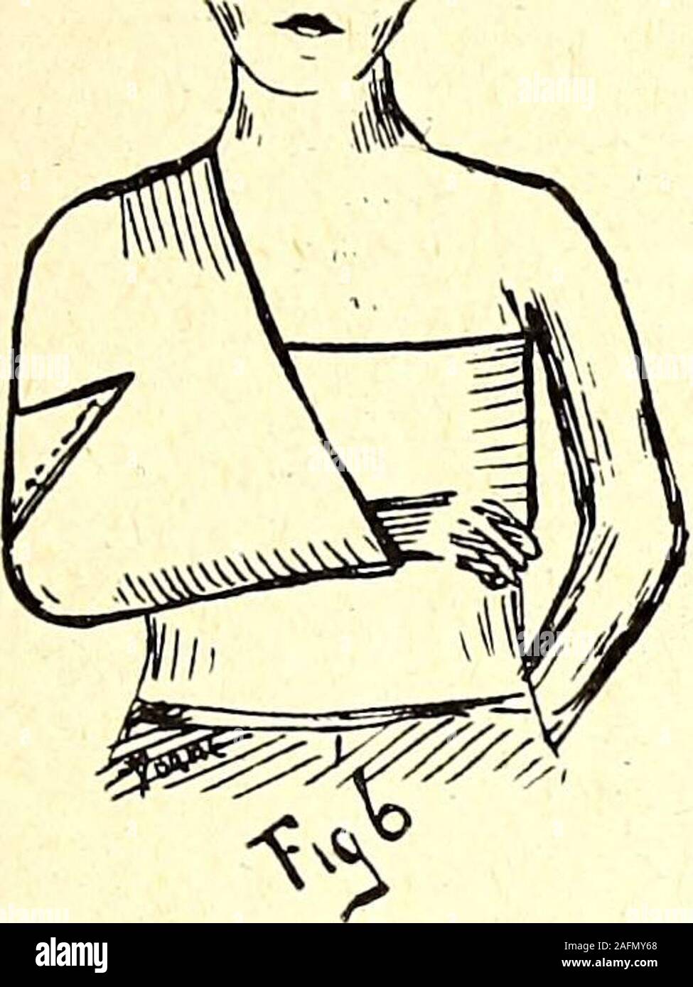 Occipital triangle hi-res stock photography and images - Alamy