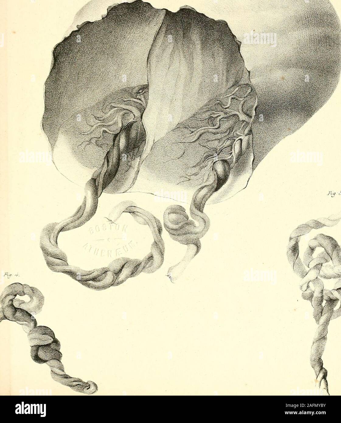 . The principles and practice of obstetric medicine : in a series of ...