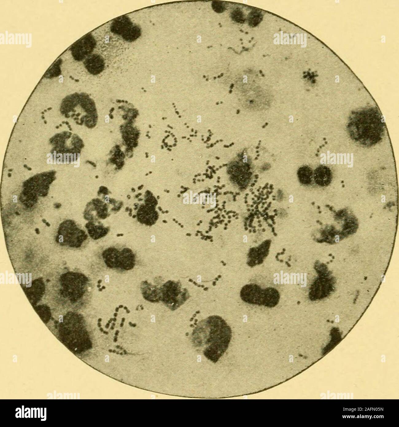 Inhalation particles hi-res stock photography and images - Alamy