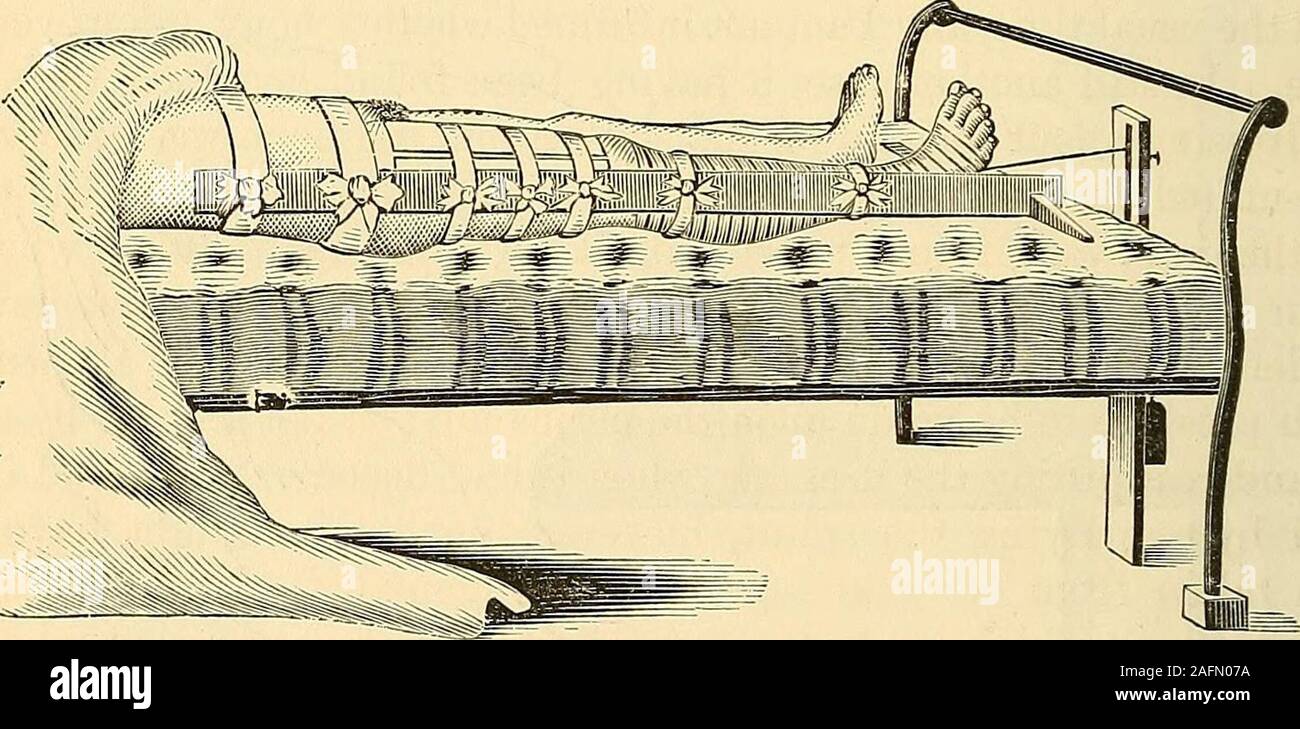 Femur condyles hi-res stock photography and images - Alamy