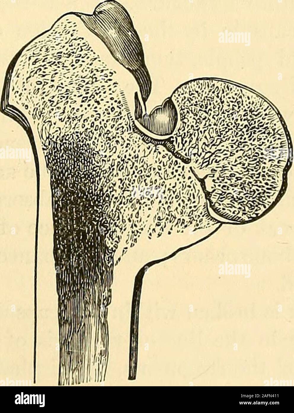 Fat tissue in the neck women hi-res stock photography and images - Alamy