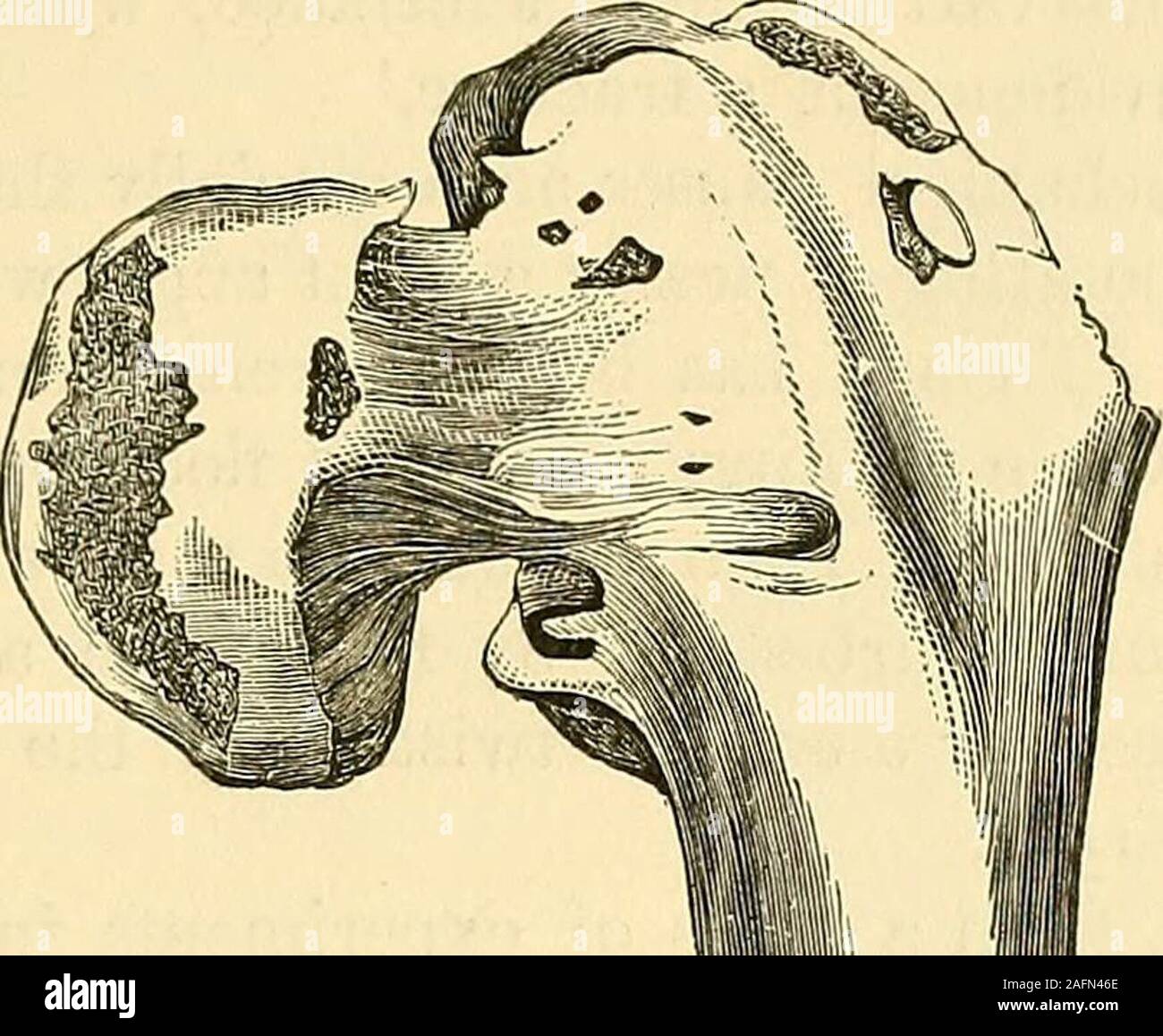 Fat tissue in the neck hi-res stock photography and images - Alamy