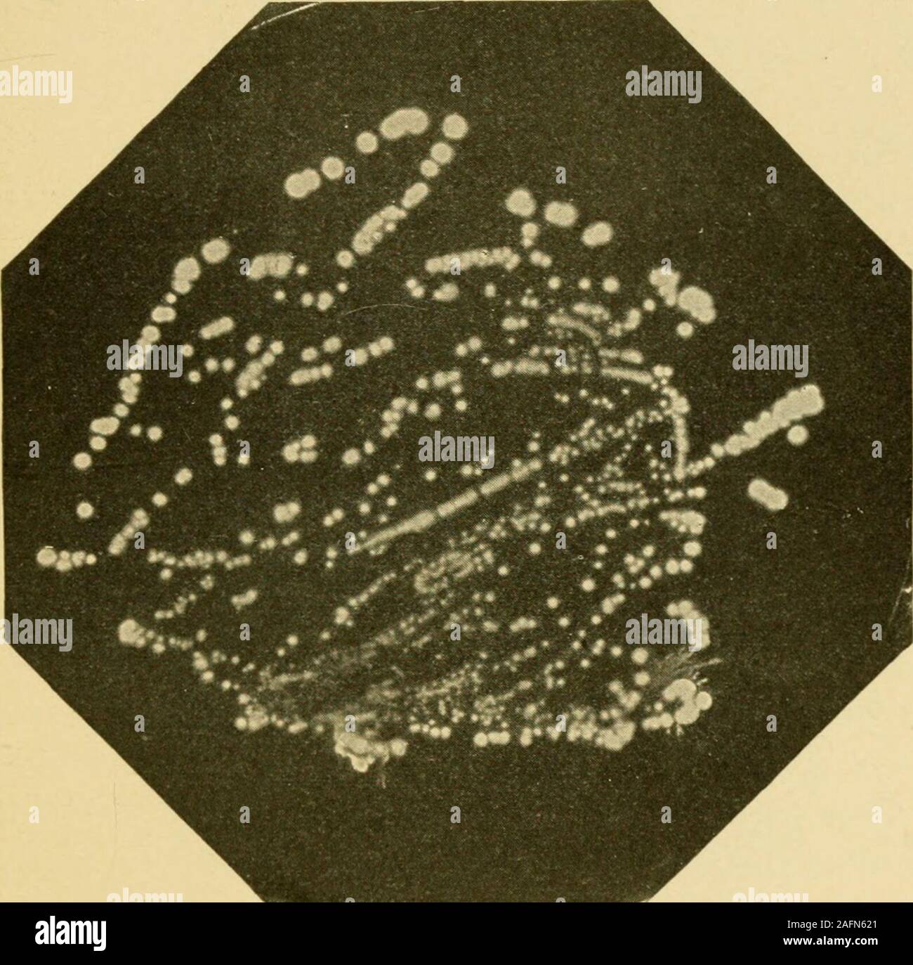 Streptococcus pyogenes tem hi-res stock photography and images - Alamy