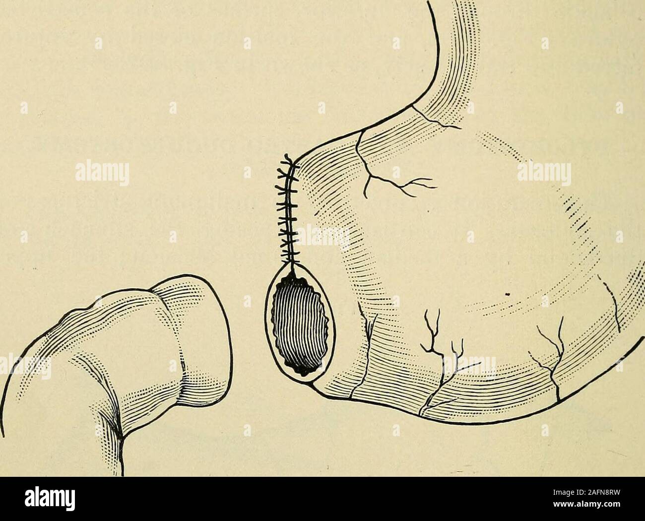 . Minor surgery and bandaging; including the treatment of fractures and ...