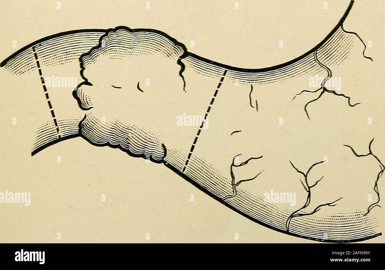 . Minor surgery and bandaging; including the treatment of fractures and ...