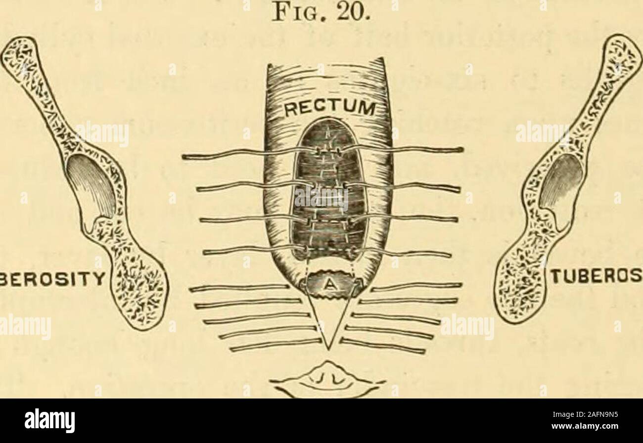 Lithotomy position hi-res stock photography and images - Alamy