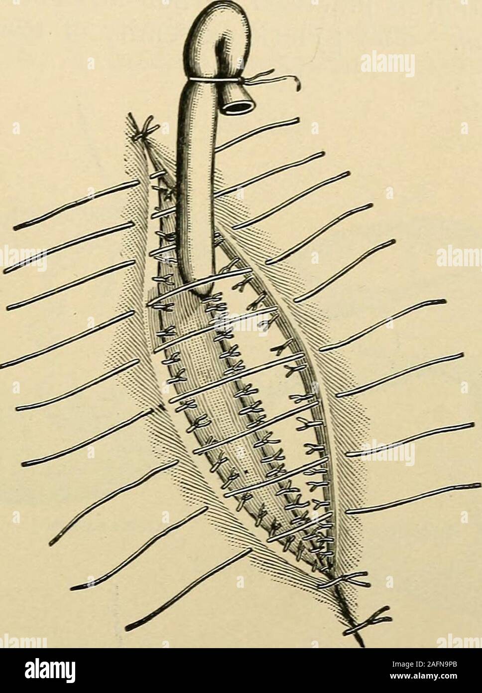 . Minor surgery and bandaging; including the treatment of fractures and ...